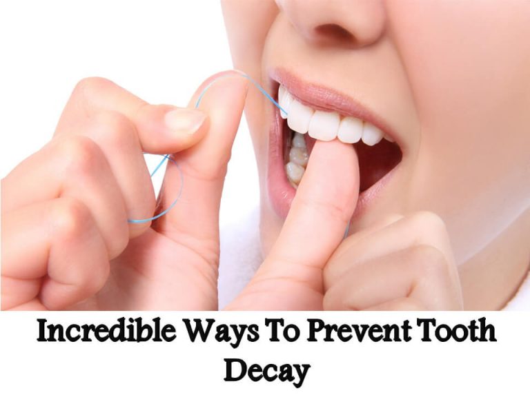 Incredible Ways To Prevent Tooth Decay - Sggreek.com